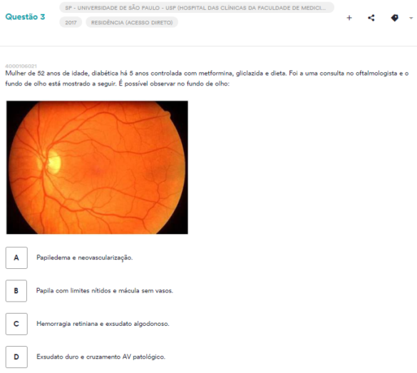 O que mais cai na prova da USP-SP em Oftalmologia